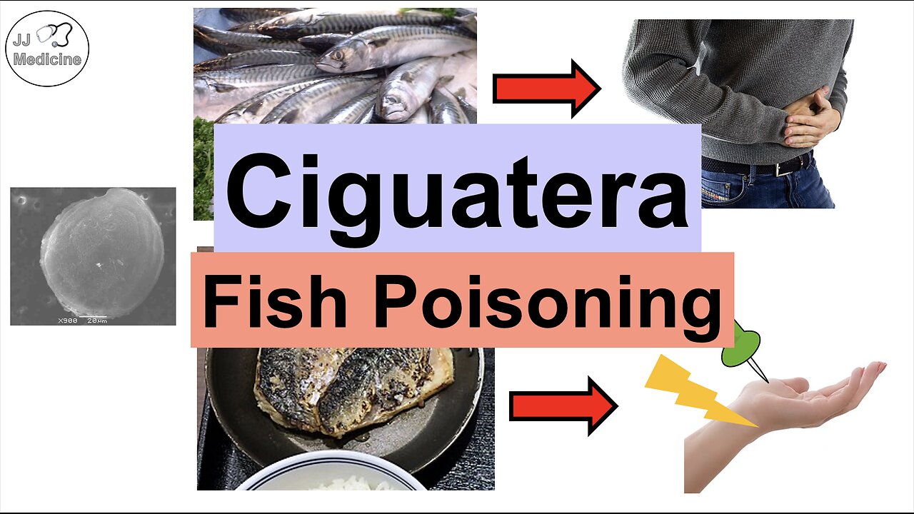 Ciguatera Fish Poisoning (Ciguatoxin) | Symptoms (Numb Feet, Diarrhea ...