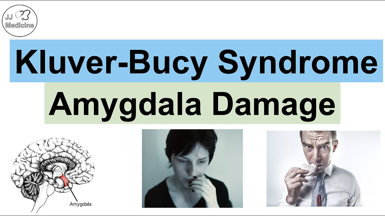 Kluver-Bucy Syndrome | Causes, Pathophysiology, Signs & Symptoms ...