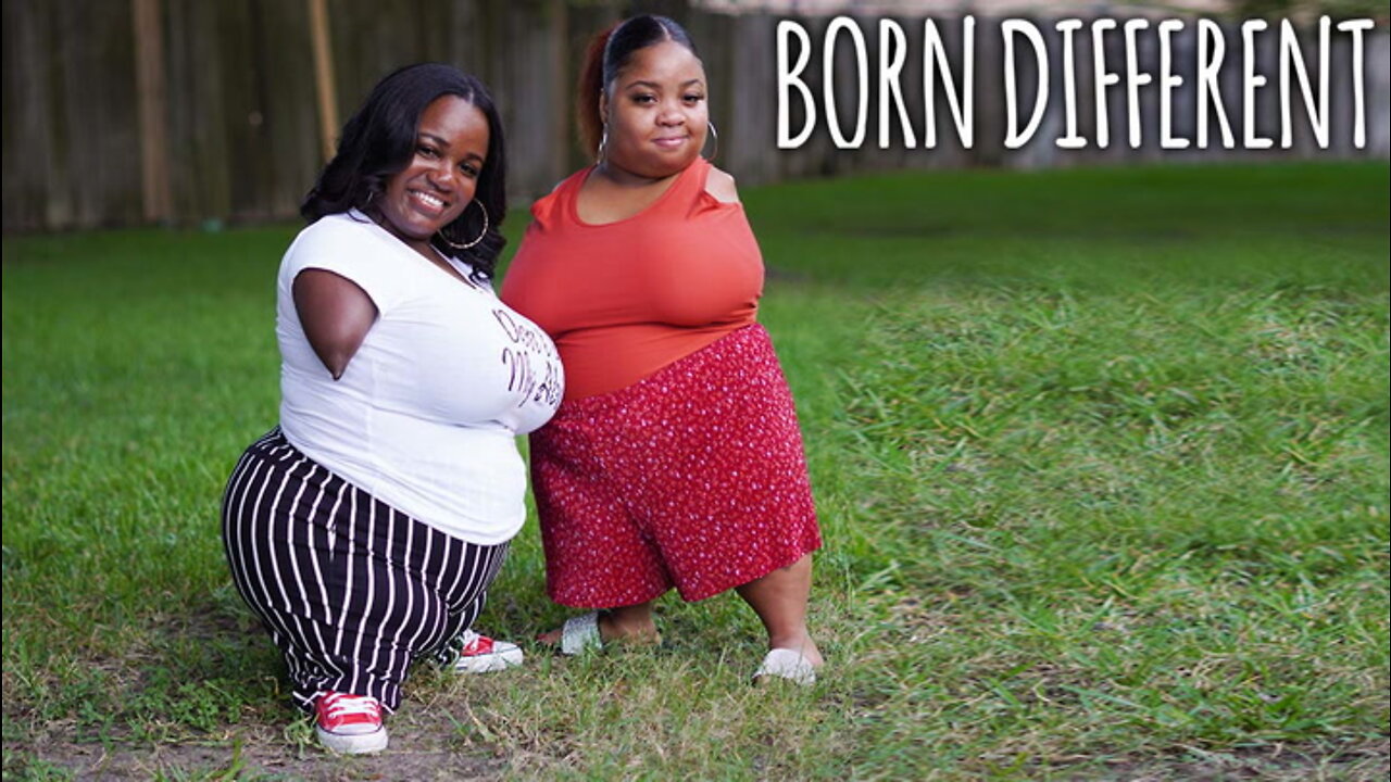 7 Extraordinary People Living Without Limbs Born Different