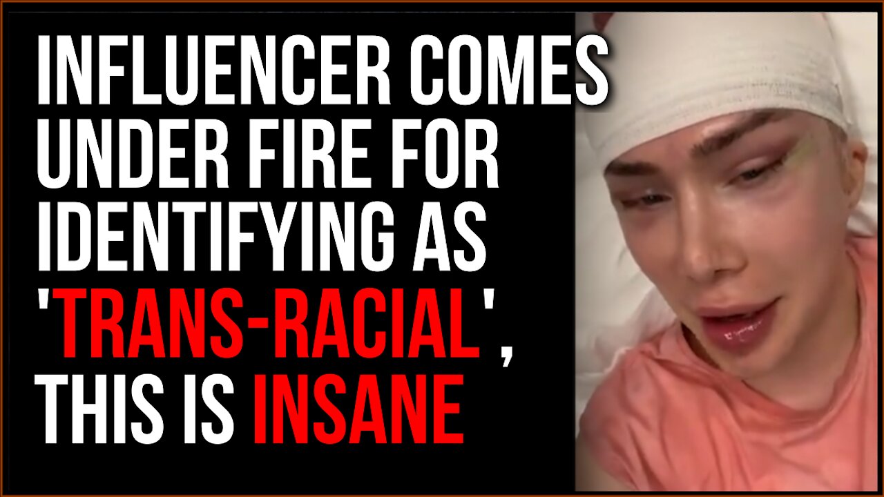 Influencer Identifies As TRANS-RACIAL, He Has Undergone 18 Surgeries To ...