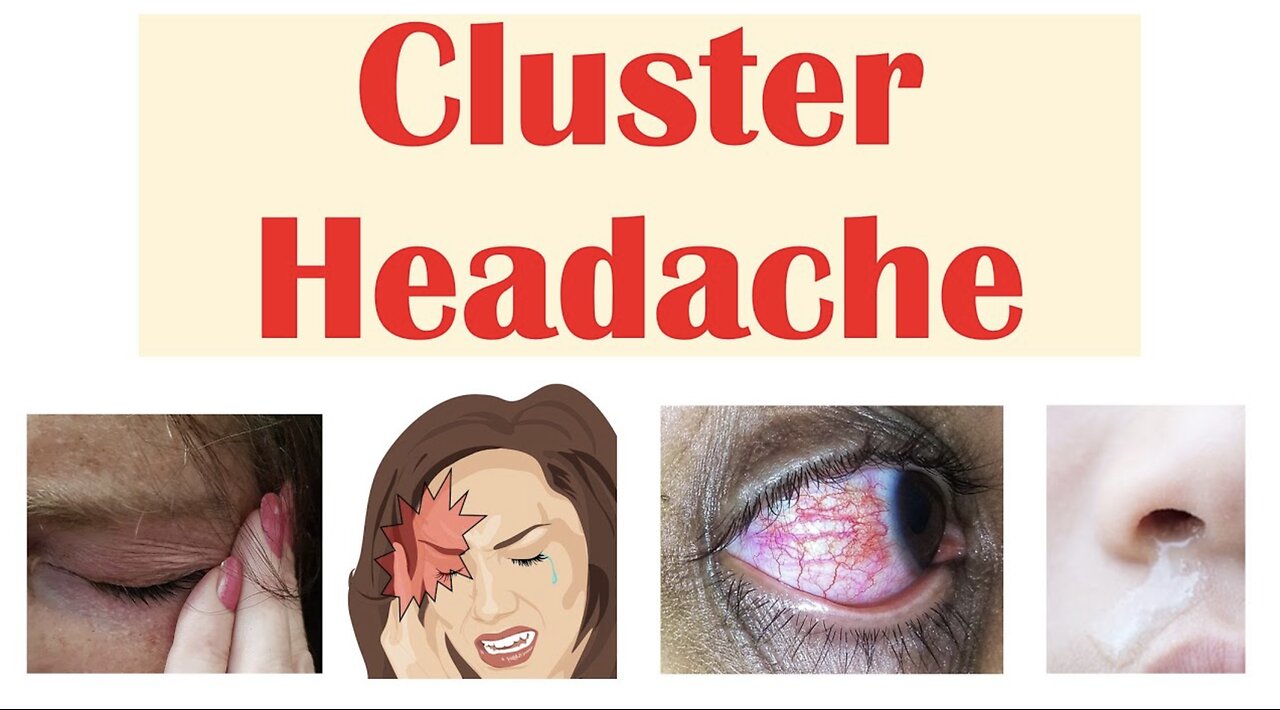 Cluster Headaches | Risk Factors, Triggers, Signs & Symptoms, Diagnosis ...