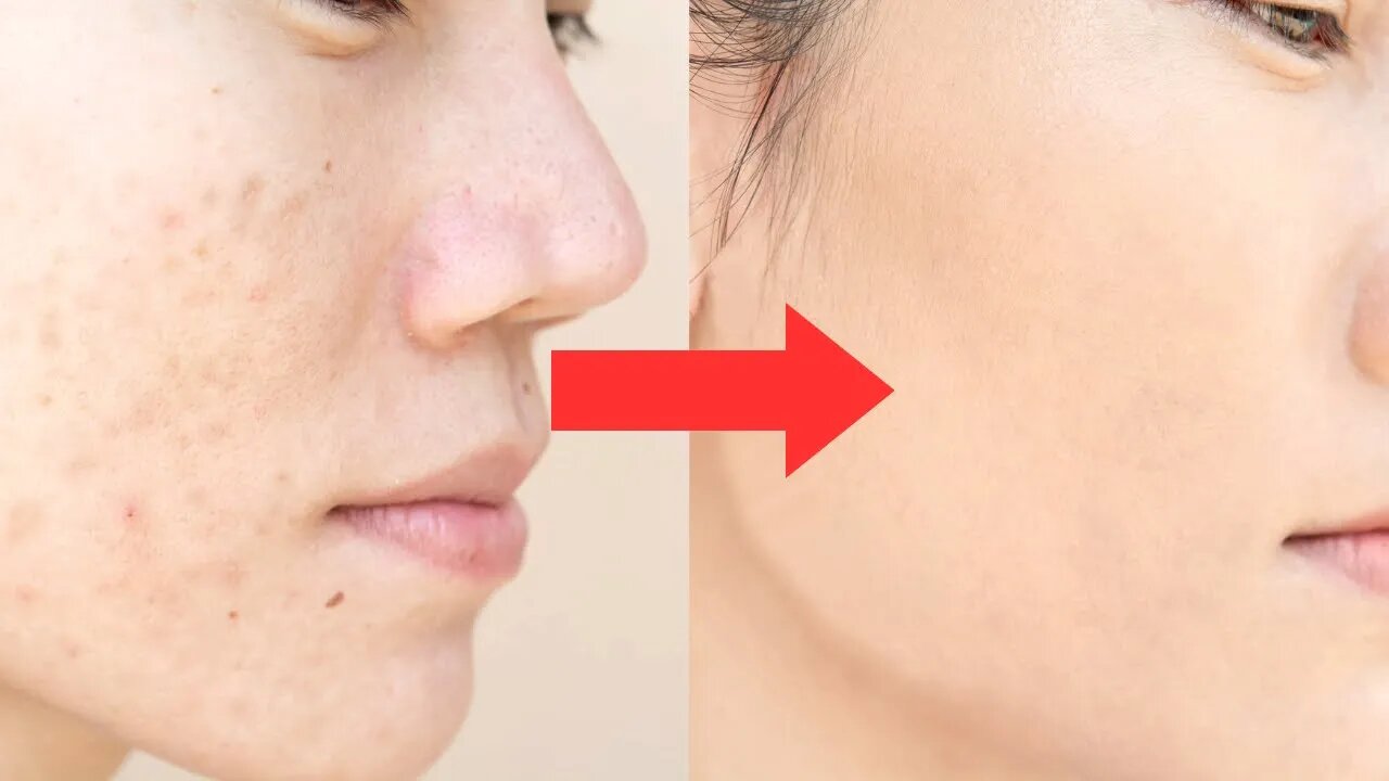 Banish Skin Issues with Essential Oils: Your Skin's New Best Friend!