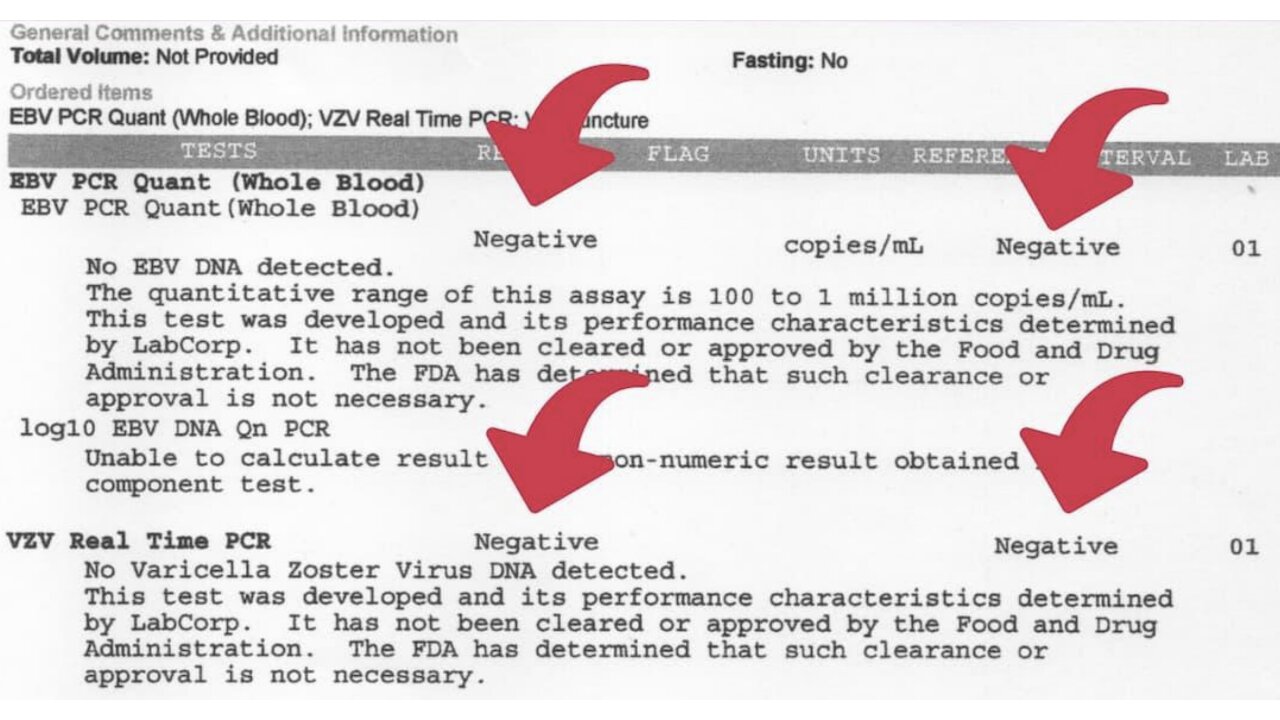 Varicella-Zoster Virus (Shingles) Negative PCR Test Result After Scalar ...