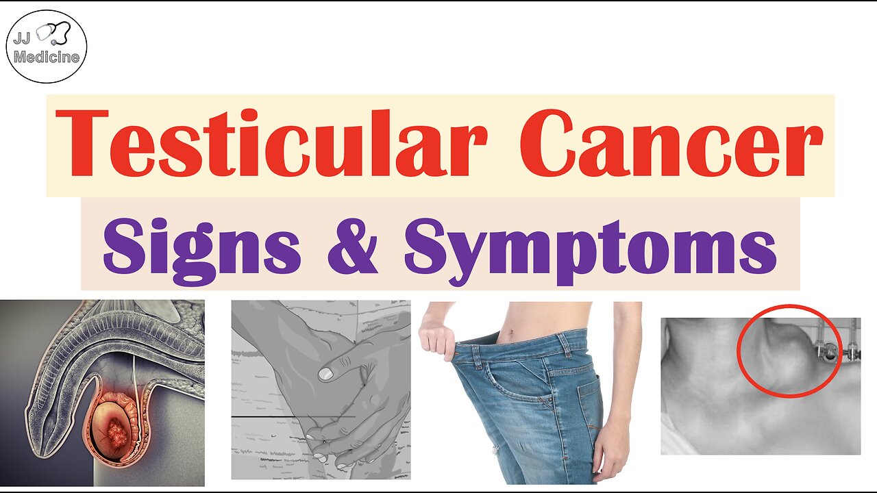 Testicular Cancer Signs And Symptoms Risk Factors And Metastases