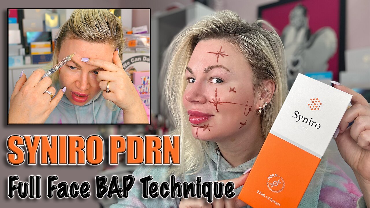 Syniro PDRN FULL FACE BAP Technique in DETAIL! AceCosm, Code Jessica10 ...