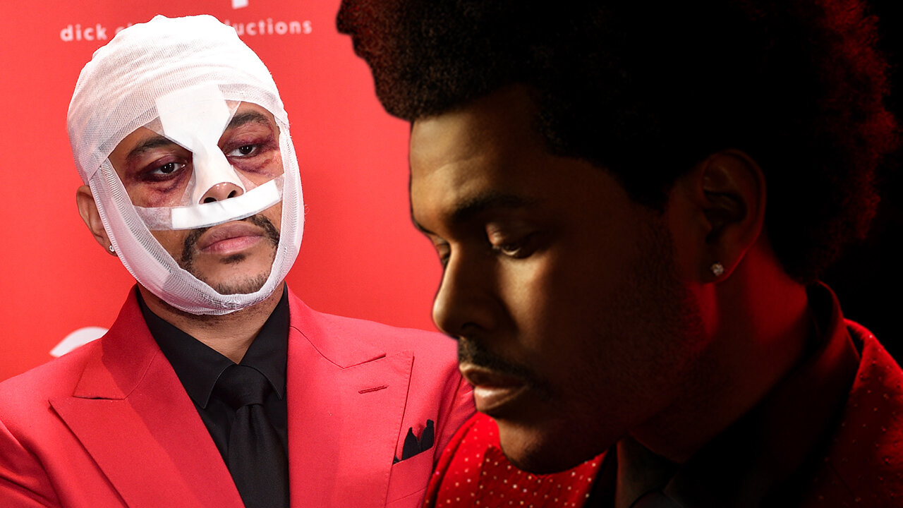 The Weeknd REVEALS Meaning Of Face Transformation & Bandages Ahead Of ...