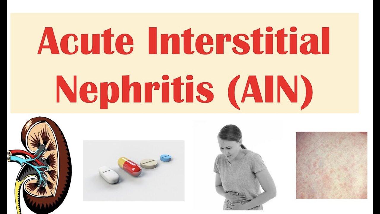 Acute Interstitial Nephritis (AIN) | Causes, Pathophysiology, Symptoms ...