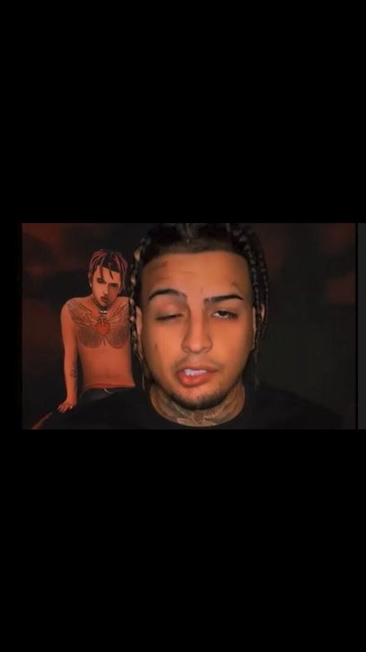 Rapper Skinnyfromthe9 announces he has Bell's palsy and tinnitus