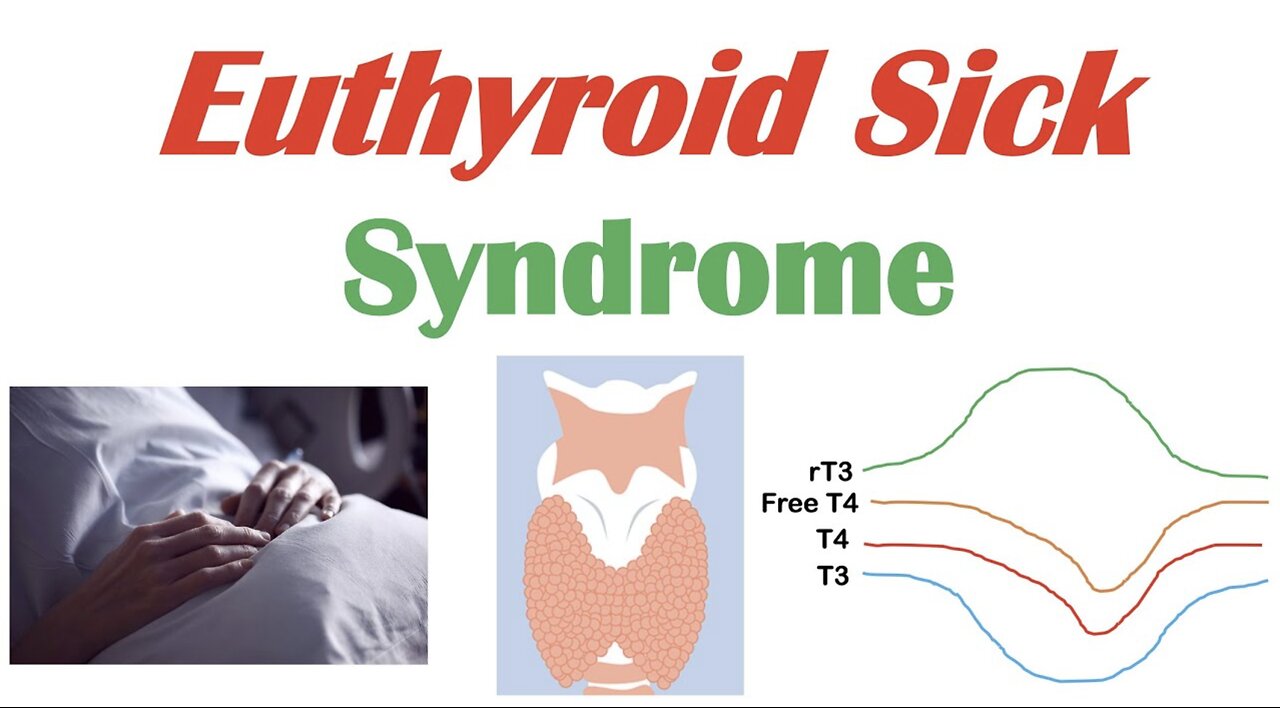 Euthyroid Sick Syndrome (Nonthyroidal Illness Syndrome) Causes ...