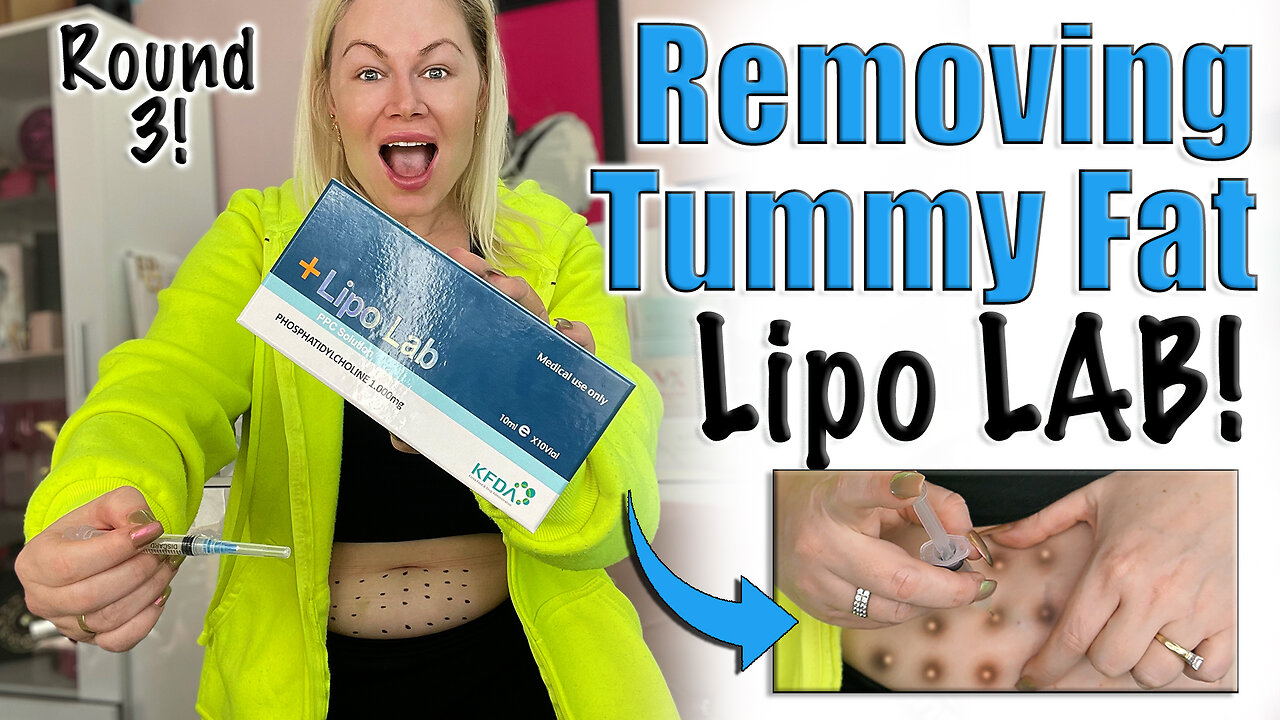 Removing Tummy Fat with Lipo Lab: Round 3, Acecosm.com | Code Jessica10 ...
