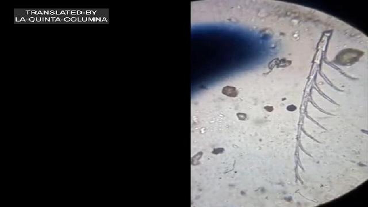 A 55-year-old male PATIENT, NOT VACCINATED, but SWABBED (Dr. Wilfred ...