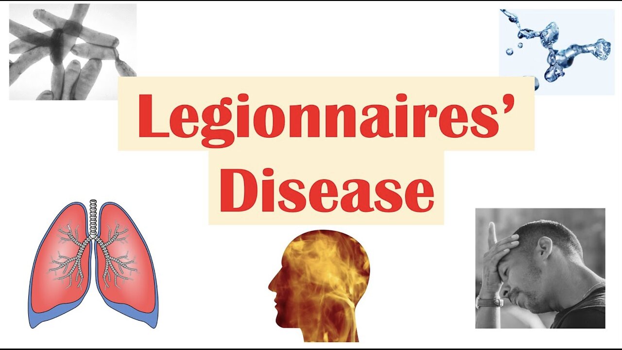 Legionnaires’ Disease | Causes, Pathophysiology, Symptoms, Diagnosis ...