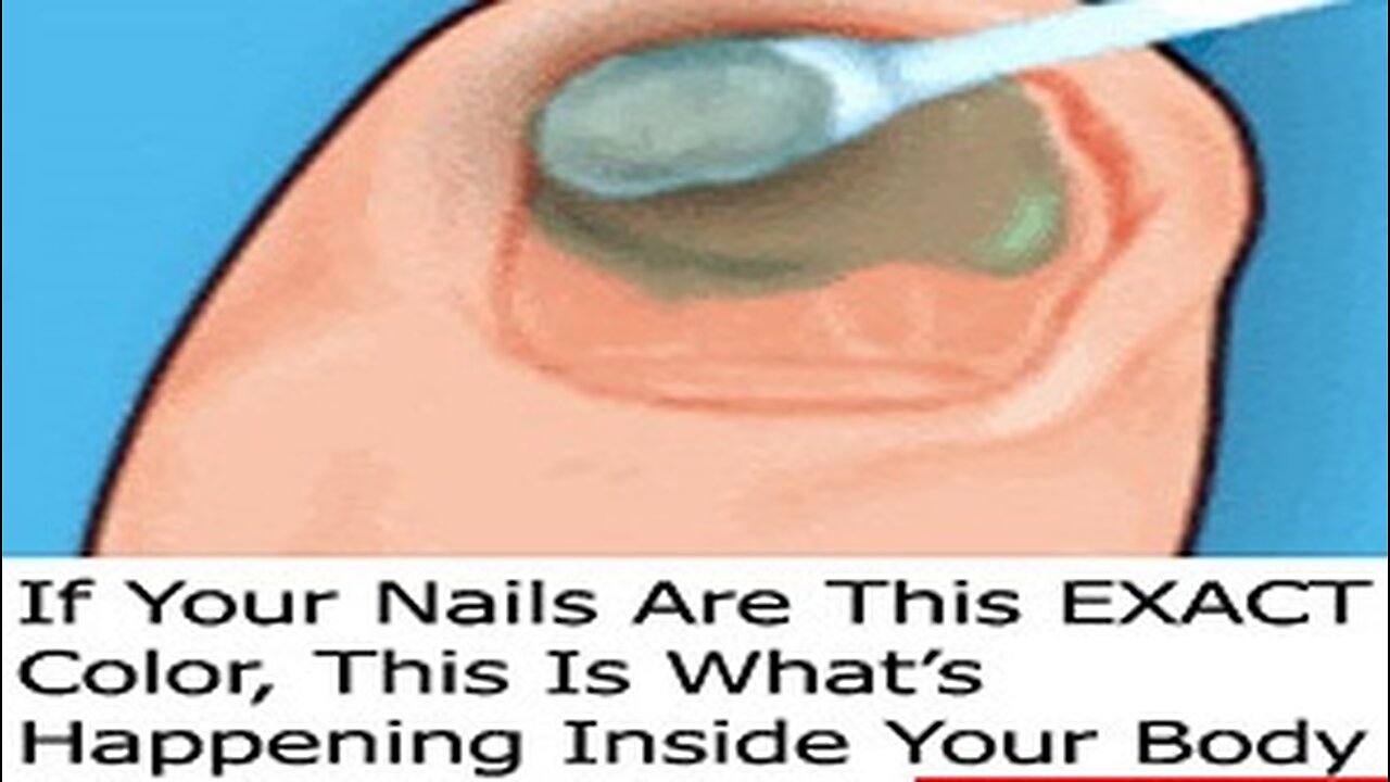 If Your Nails Are This EXACT Color, This Is What's Happening Inside ...