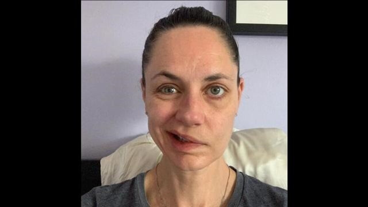 Canadian actress Jennifer Gibson develops Bell's Palsy after her ...