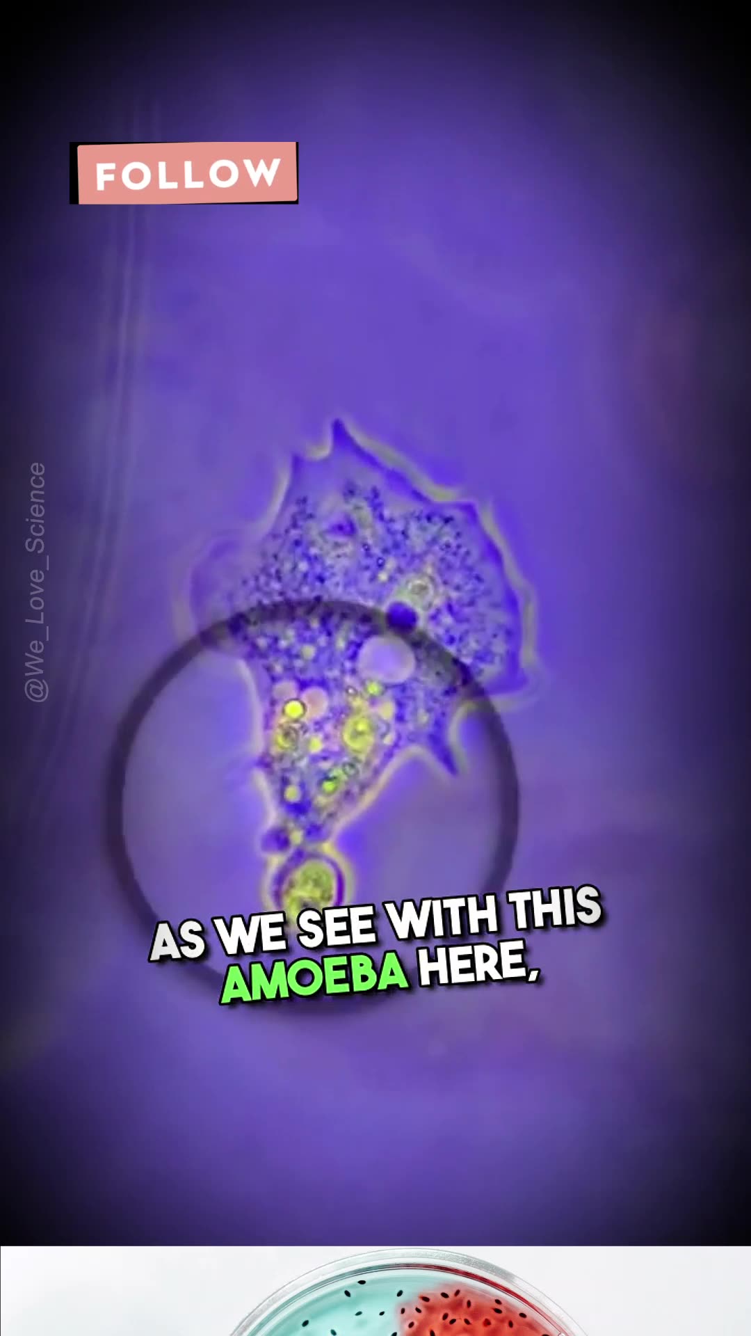 How Do Amoebas Poop?