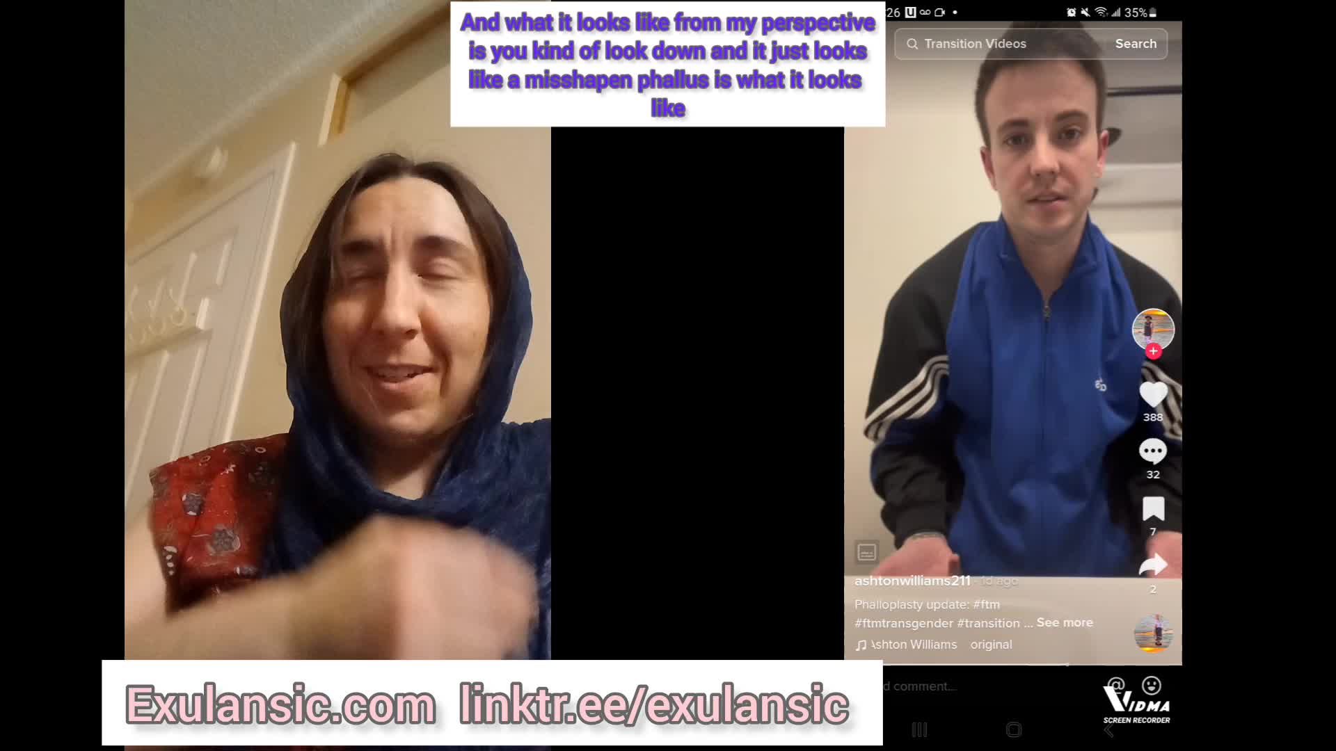 Phalloplasty Microphile: "The Point of this Surgery is to have it Not ...