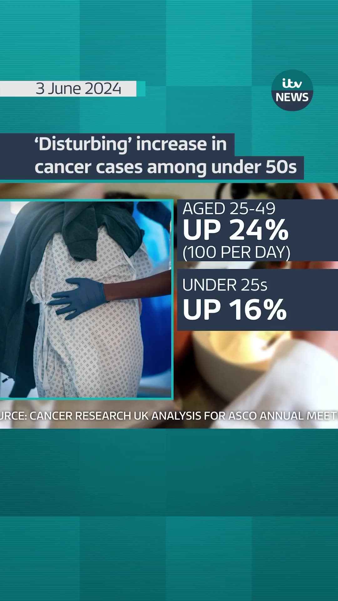 “Disturbing Increase in Cancer cases among Under 50’s"