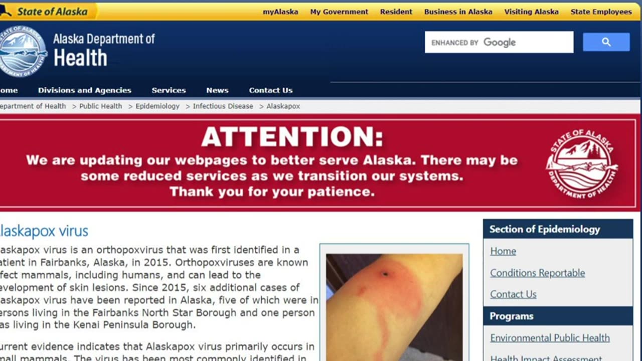 Mary Greeley News - ⚠ ALERT First Dearth From Alaskapox Virus In ...