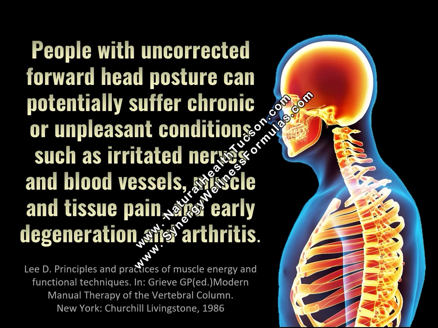 Research/Facts: Accidents, injury, pain, forward head posture, thyroid ...