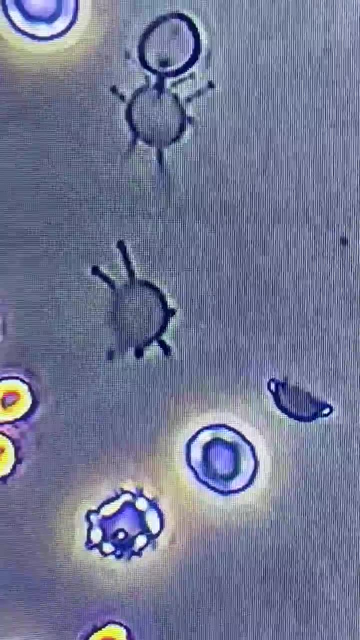 Microscopy Reveals Spike Protein Being Born OUT of the Red Blood Cell ...